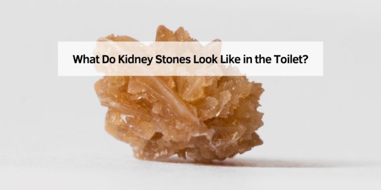 What Do Kidney Stones Look Like in the Toilet?